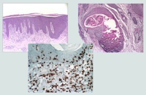 Medica Skin Diagnostics | A private, independent dermpath diagnostic ...